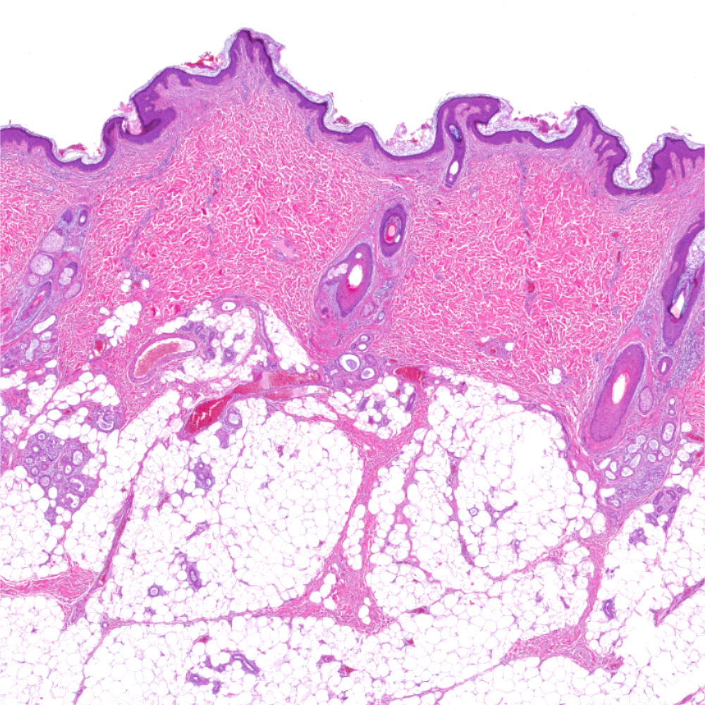Interactive Online Course: Basics in Dermatopathology • guestoo.de